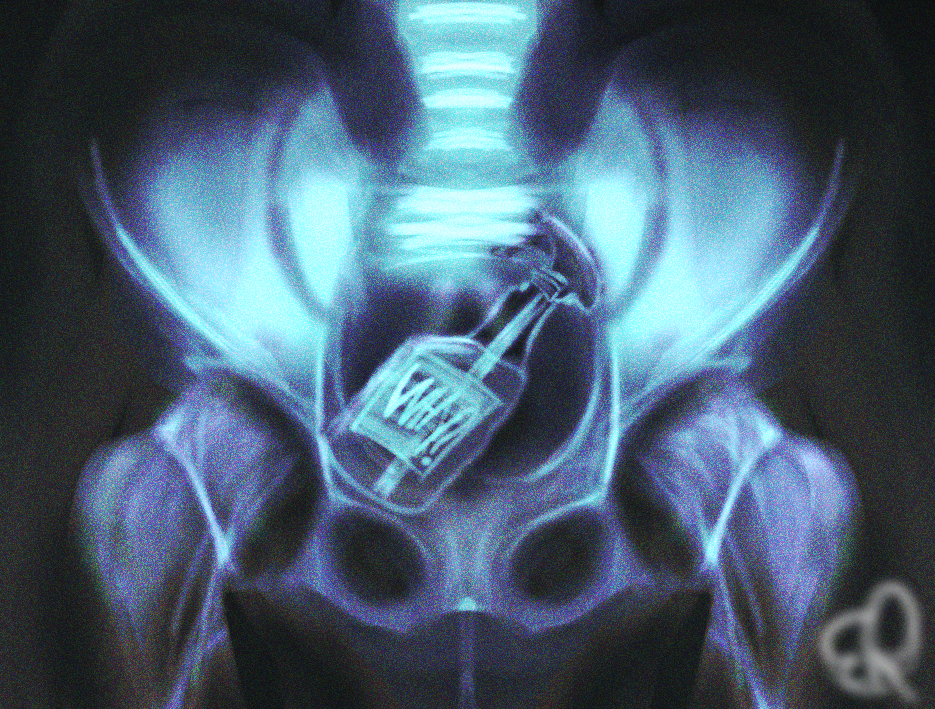 A completely normal X-ray - ibisPaint