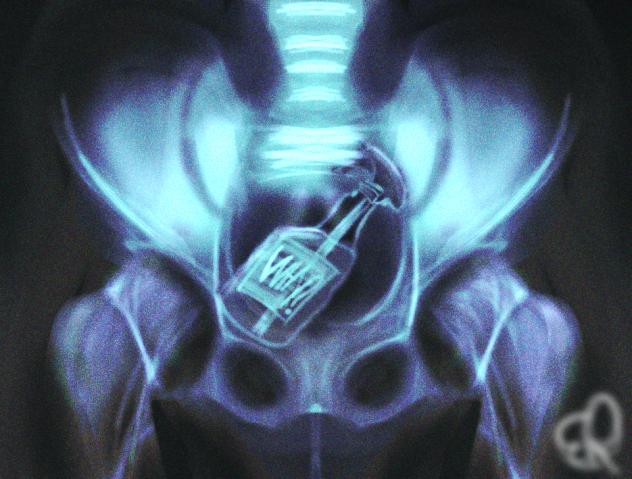 A completely normal X-ray - ibisPaint