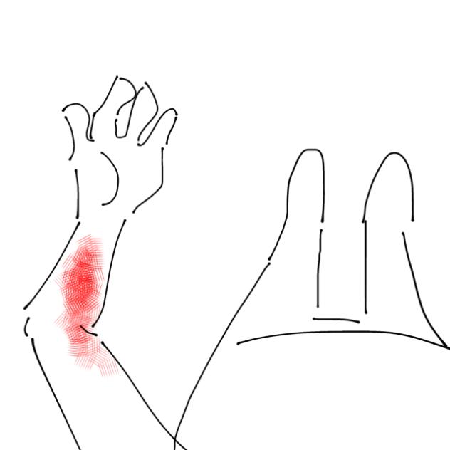 Stitches - ibisPaint