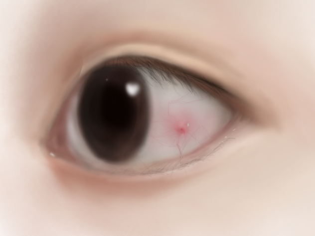 Hurt Day1 - ibisPaint