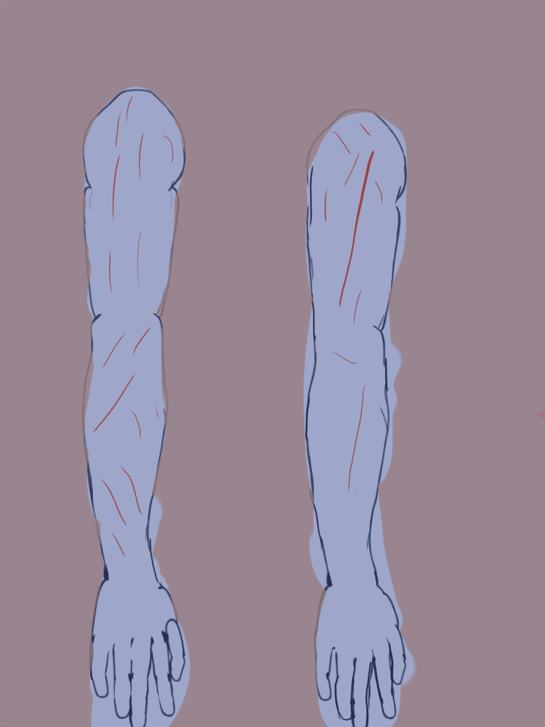 My arms rn TW🚨🚨( vent ) - ibisPaint