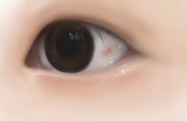 Hurt Day2 - ibisPaint