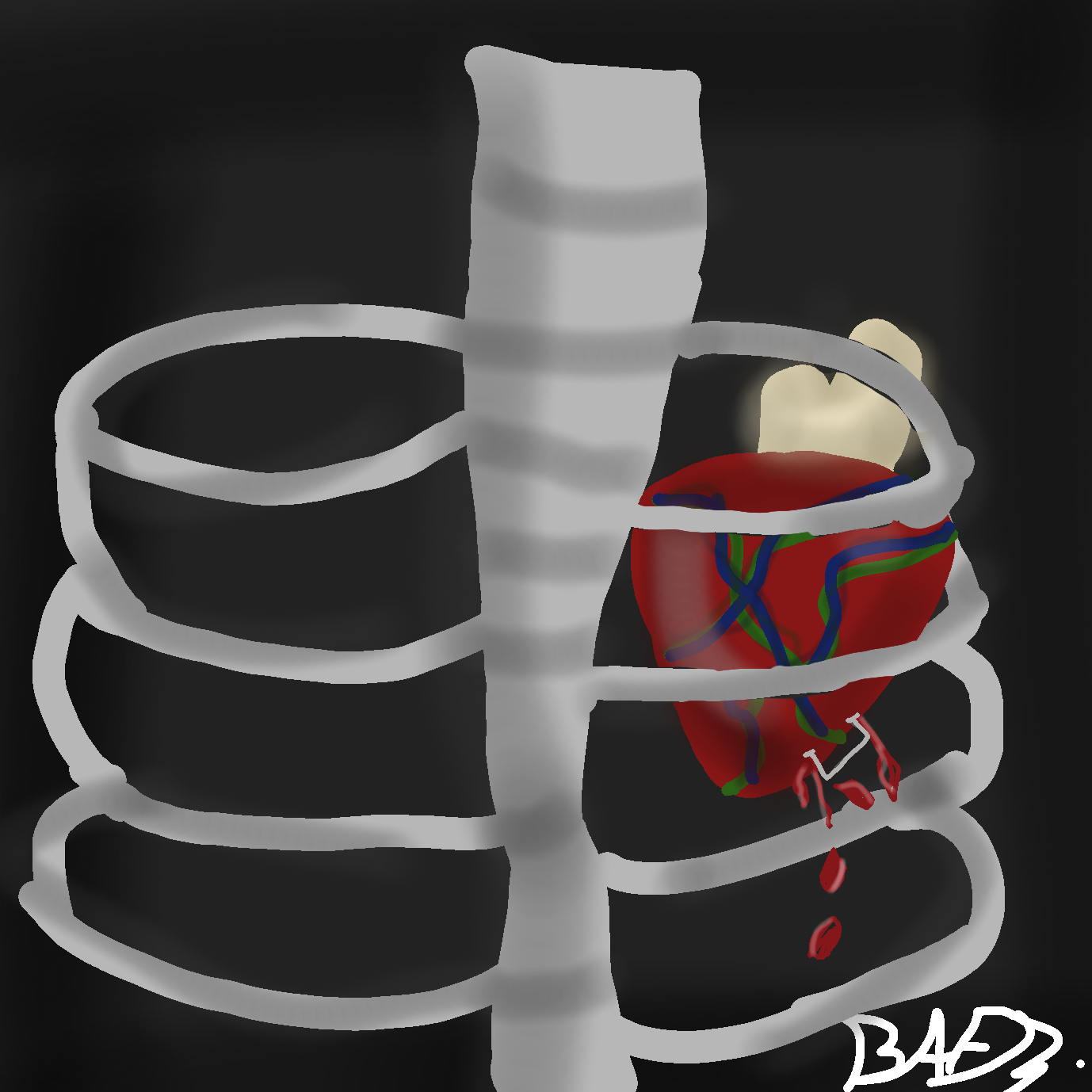 stapled heart and bones - ibisPaint