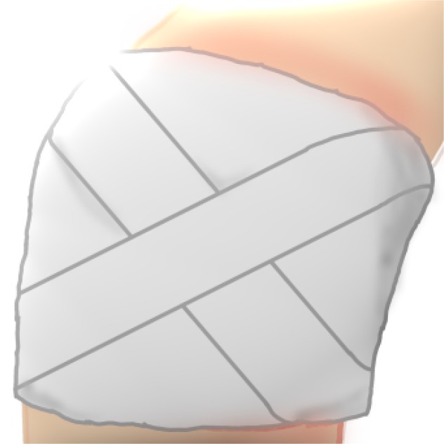 A healing knee - ibisPaint