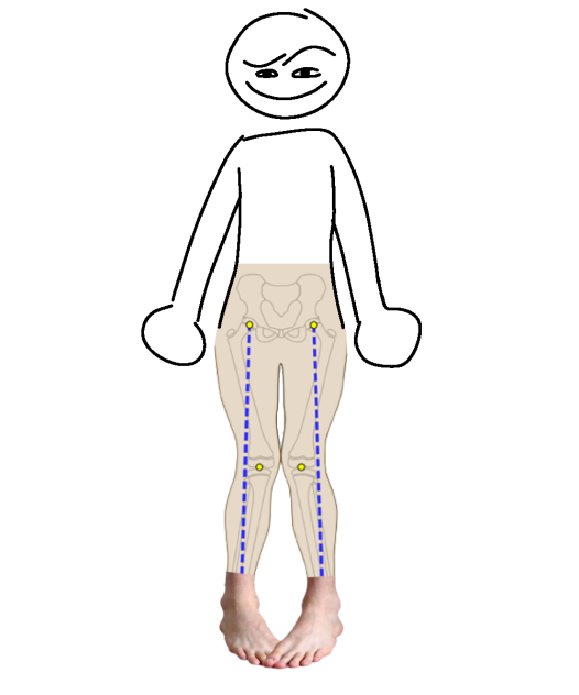 people with knock knees and intoeing - ibisPaint
